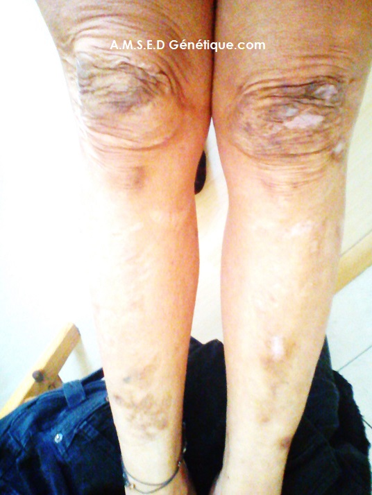 "Espoir" pour le SED et si c'était vous? - Ulule